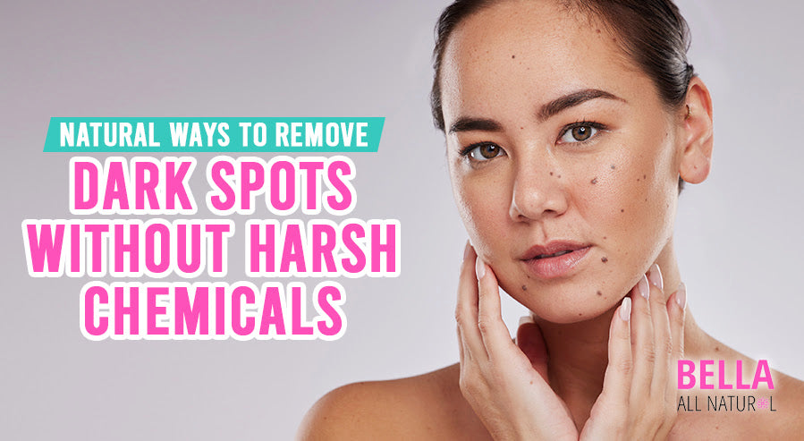 Natural Ways to Remove Dark Spots Without Harsh Chemicals – Bella All ...