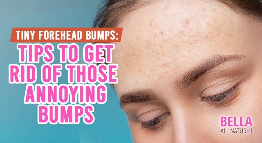 Tiny Forehead Bumps: Tips to Get Rid of Those Annoying Bumps – Bella ...